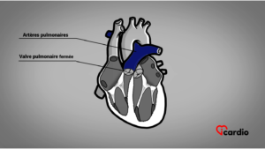 Physiologie cardiaque et circulation sanguine – Icardio