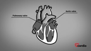 Tricuspid valves – Icardio