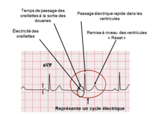 L’électrocardiogramme (ECG) – Icardio