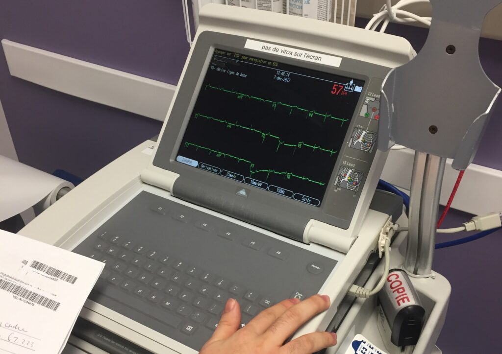 L’électrocardiogramme (ECG) – Icardio