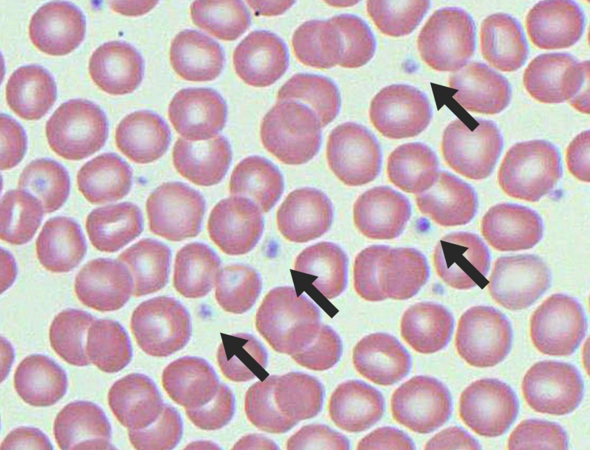 Les plaquettes – Icardio