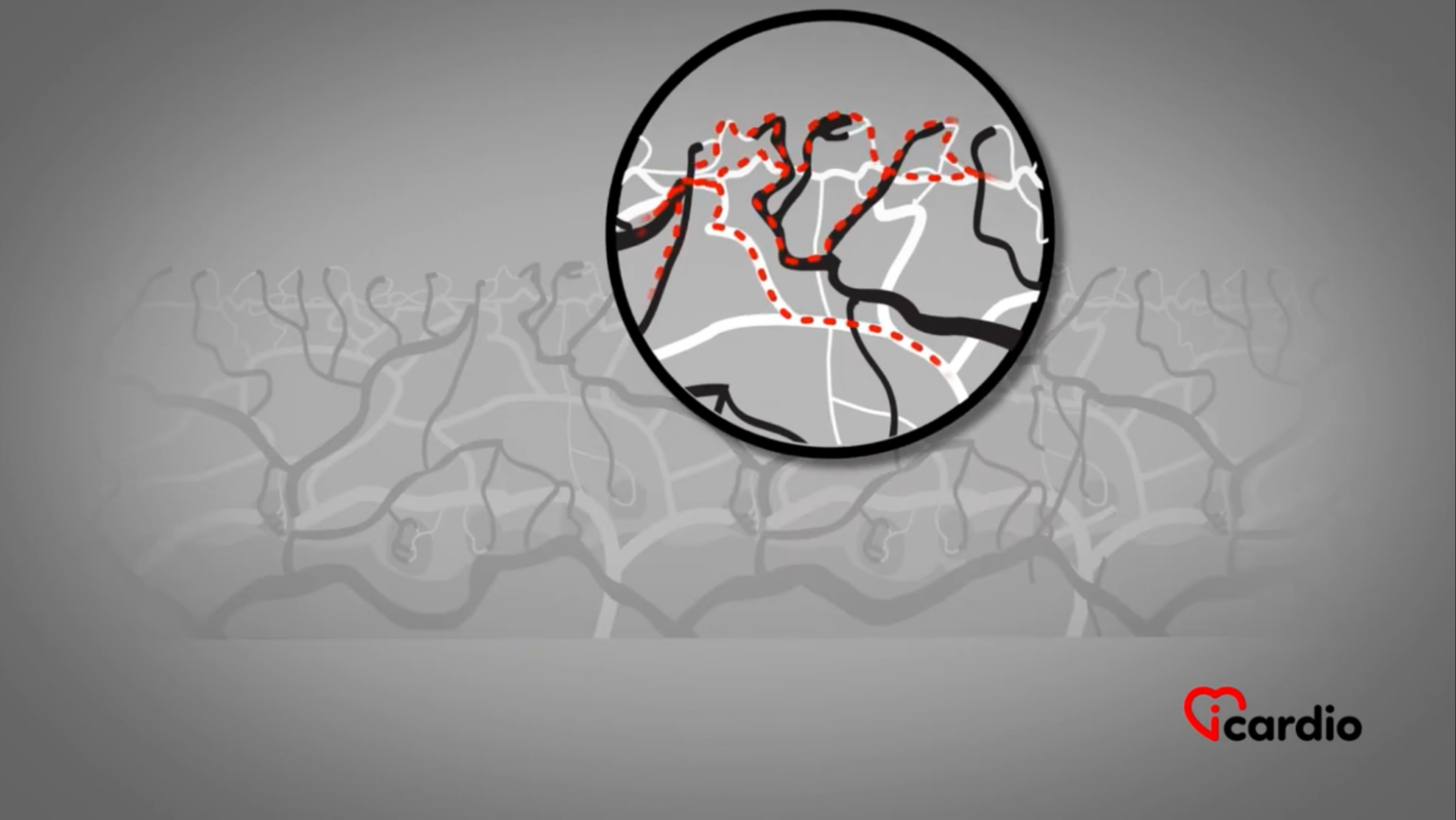 Systemic capillaries – Icardio