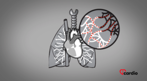 Pulmonary capillaries – Icardio