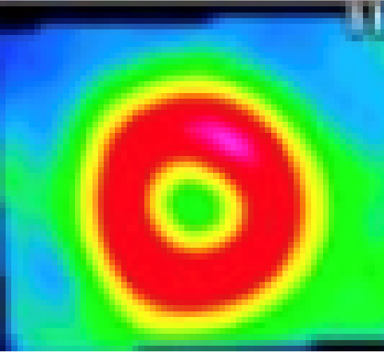 Myocardial perfusion imaging or stress MIBI scan – Icardio