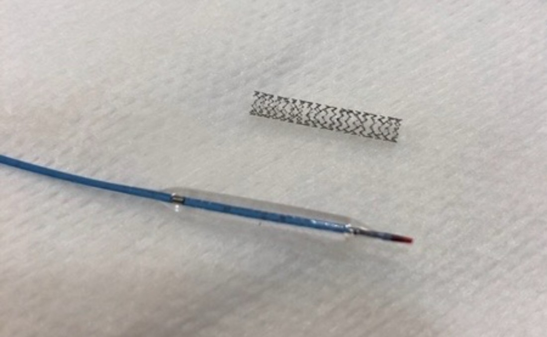 Myocardial infarction – STEMI – Icardio