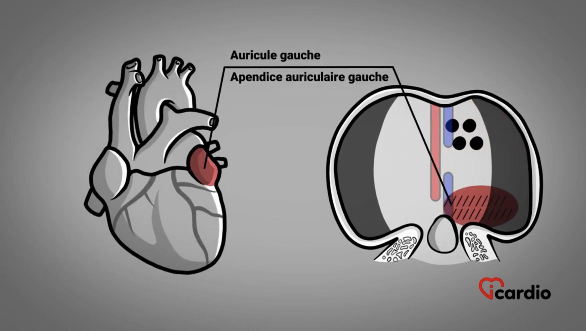 Développement des oreillettes et du retour veineux – Icardio