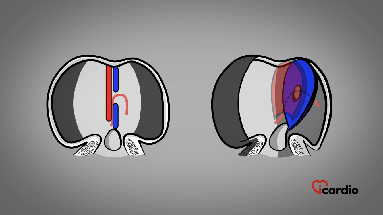 The Formation of the Atria and Venous Return – Icardio