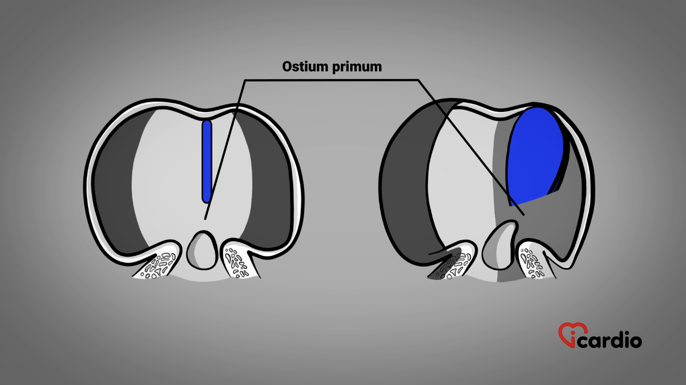 The Formation of the Atria and Venous Return – Icardio