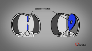 The Formation of the Atria and Venous Return – Icardio