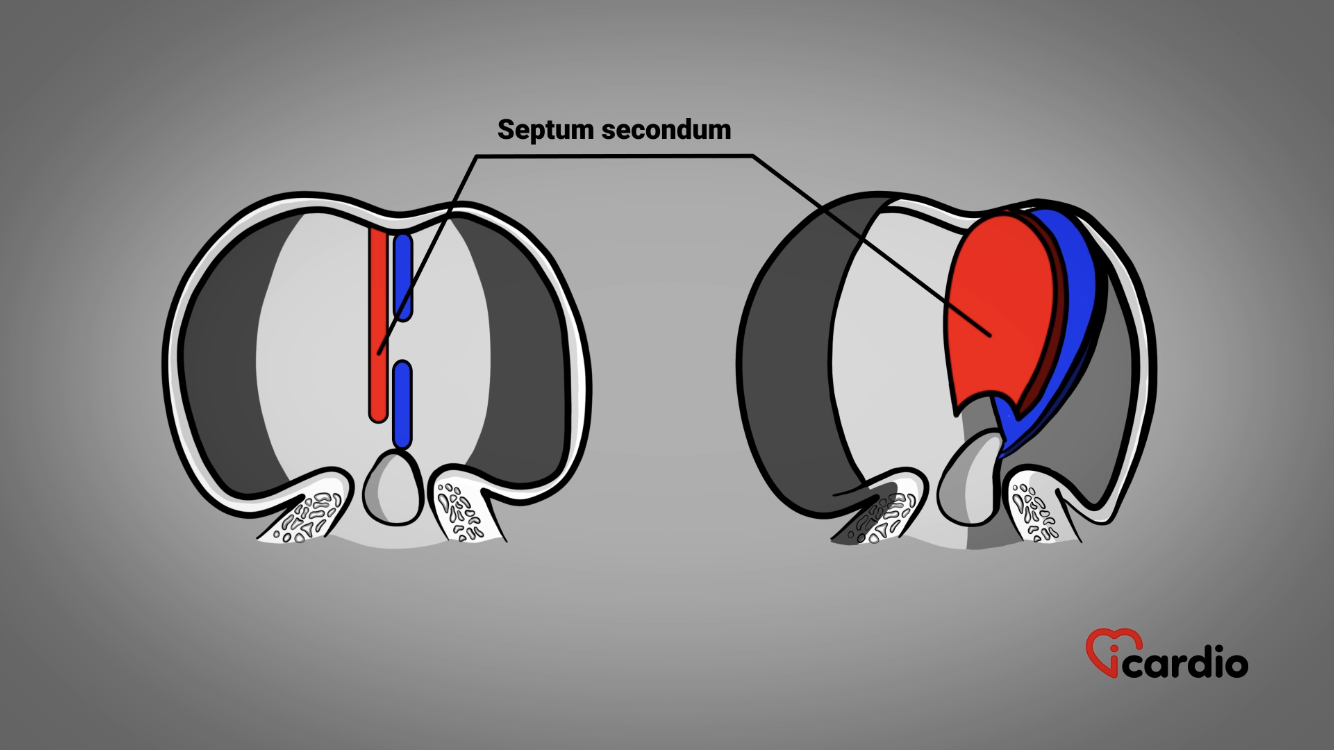 The Formation of the Atria and Venous Return – Icardio