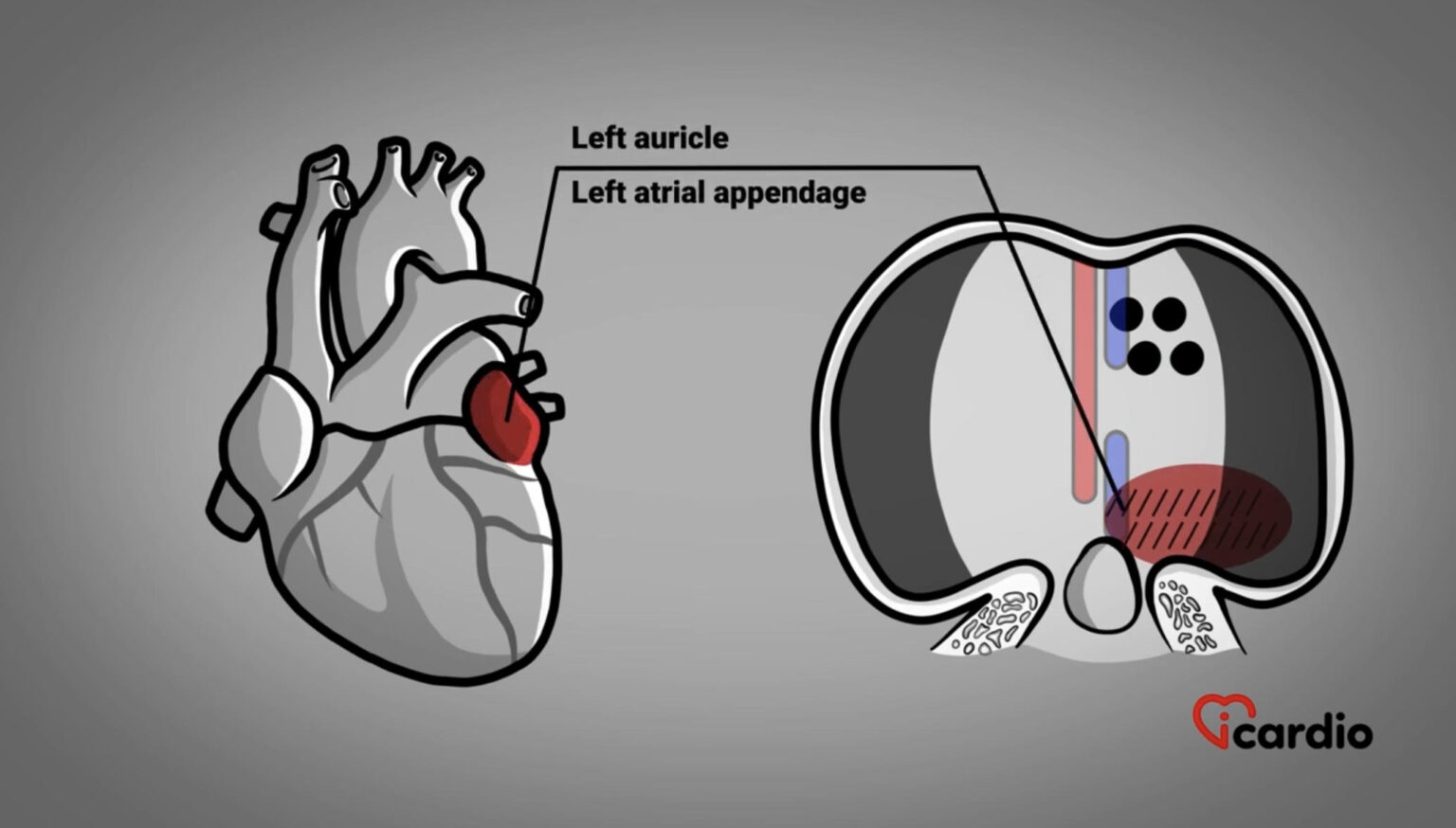 The Formation of the Atria and Venous Return – Icardio
