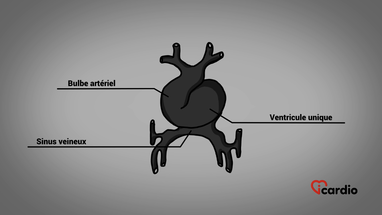 La formation des ventricules et des gros vaisseaux artériels – Icardio