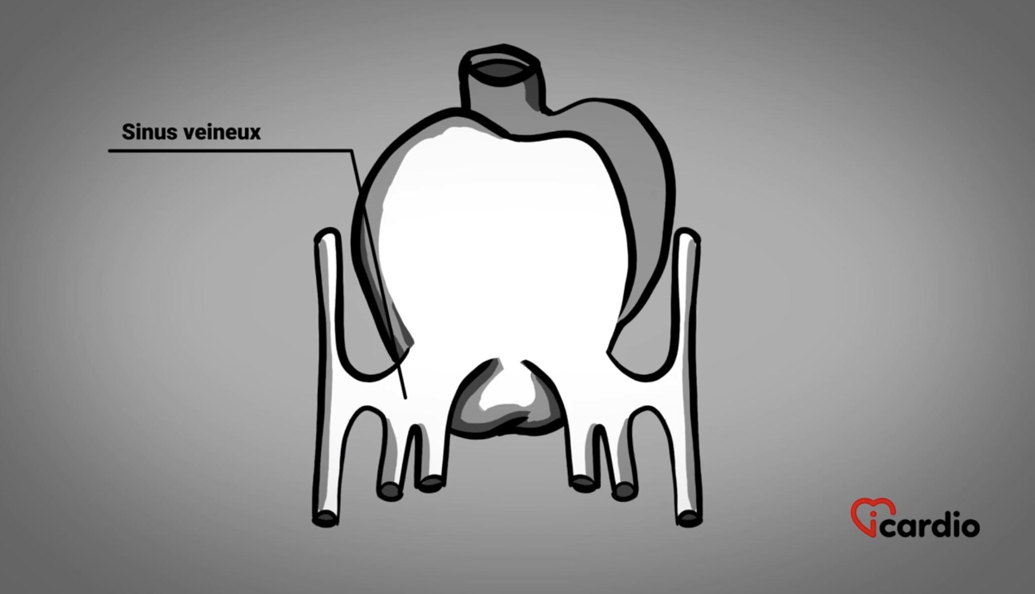 Développement des oreillettes et du retour veineux – Icardio
