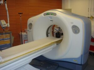 Calcium Score (Cardiac CT Scan) – Icardio