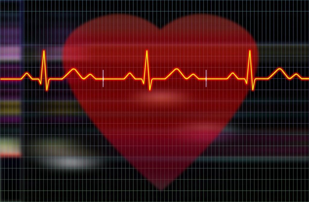La clinique des cardiostimulateurs et des défibrillateurs – Icardio